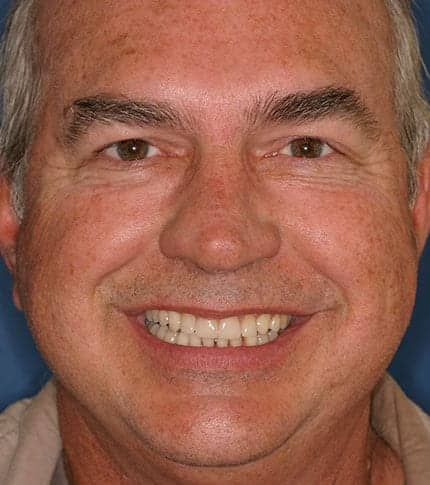 Smile Gallery | Lexington KY cosmetic dentist | Arnold Dental
